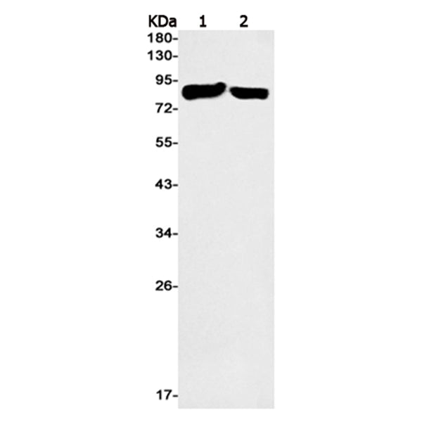 SLC6A5 Rabbit Monoclonal Antibody - High Specificity Neurotransmitter ...